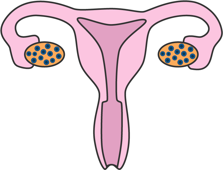 Pcos V1 - Naturopathy - (800x800) Png Clipart Download