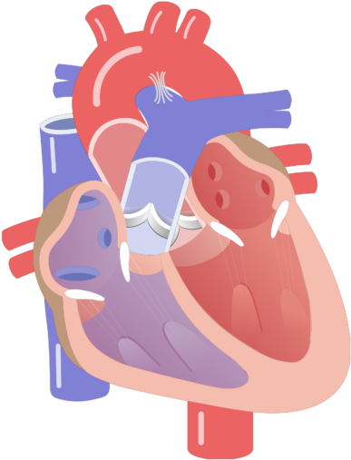 Movement Of The Heart Valves Animation Slide - Cardiac Conduction ...