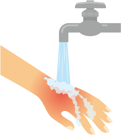 Burn Skin First Aid Dressing Illustration - Burn First Aid Cartoon ...