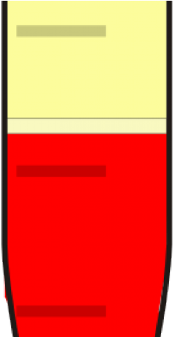 Plasma Clipart Blood Plasma - Plasma Clipart Blood Plasma - (640x480 ...