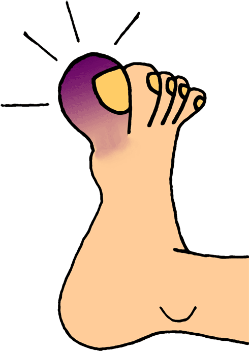 Broken Foot Cartoon - Toe Clip Art - (500x706) Png Clipart Download