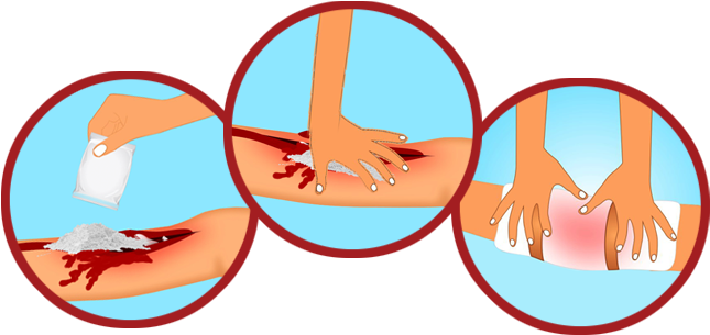 Wound Clipart Hemorrhage - Stop The Bleeding Png - Full Size PNG ...