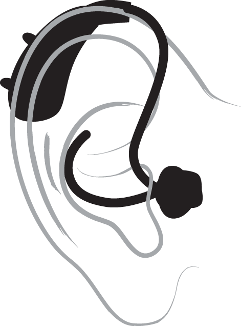Behind The Ear - Ear With Hearing Aid Drawing - Full Size PNG Clipart ...