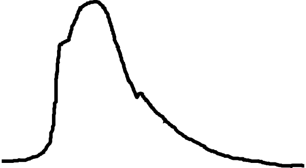 Blood Pressure Waveform Clip Art - Line Art - (600x330) Png Clipart ...