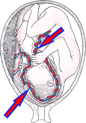 Umbilical Cord - Functions Of The Umbilical Cord - (361x515) Png Clipart Download