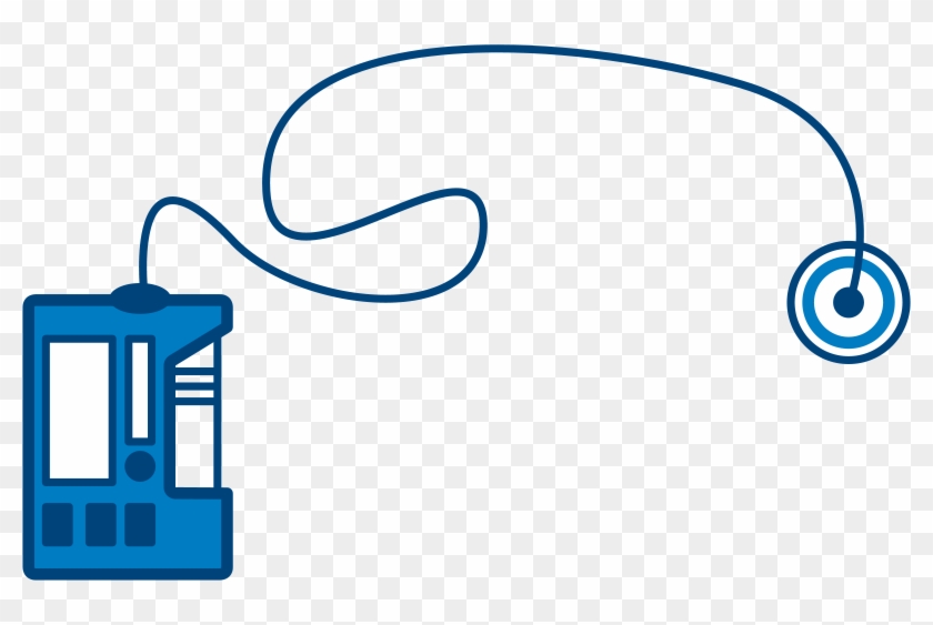 What Is An Artificial Pancreas Jdrf Pancreas Anatomy - Artificial ...