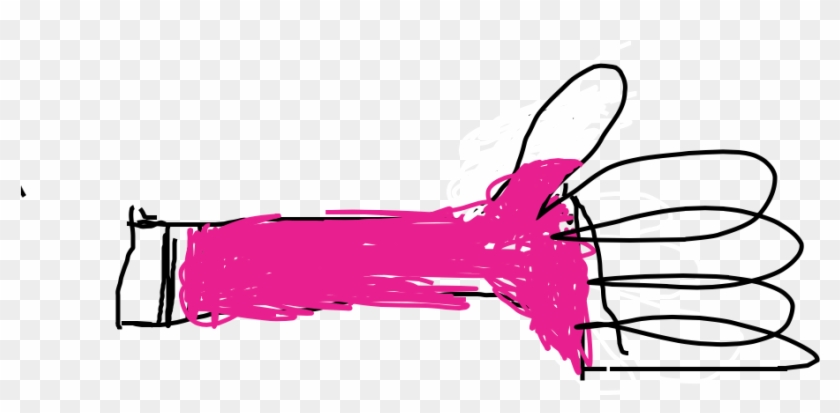 She Got A Cast In Pink After 6 Weeks, She Got It Off - Illustration ...