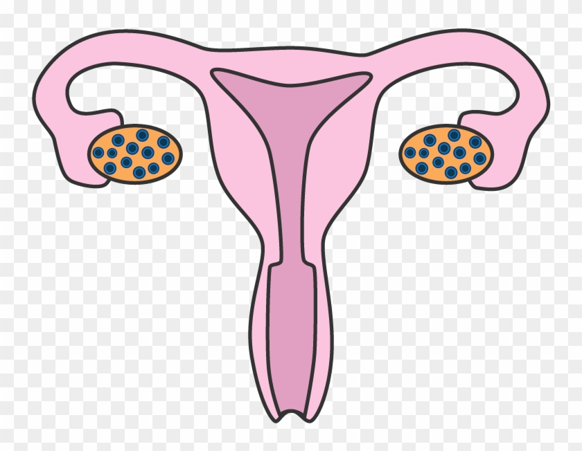 Pcos V1 - Naturopathy - Free Transparent PNG Clipart Images Download