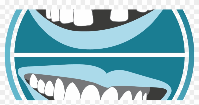 Dental Implants A Super Solution For Missing Teeth - Dental Implants A ...