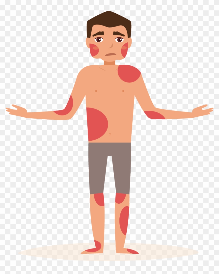 Eczema - Cartoon - Free Transparent PNG Clipart Images Download