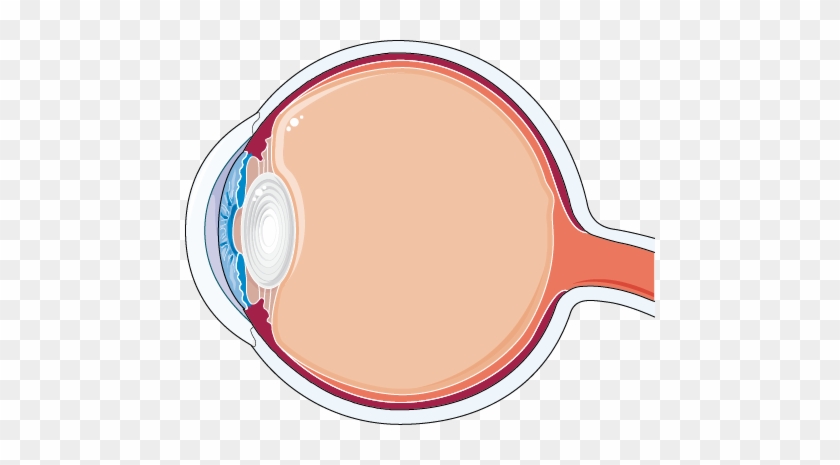 Cataract - Cataract Surgery - Full Size PNG Clipart Images Download