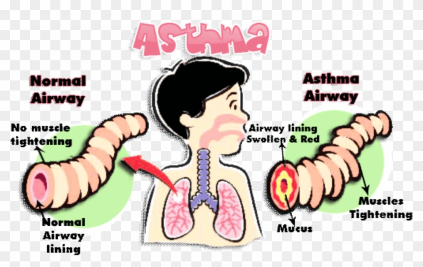 Screen 3 On Flowvella - Omega 3 And Asthma - Full Size PNG Clipart Images Download