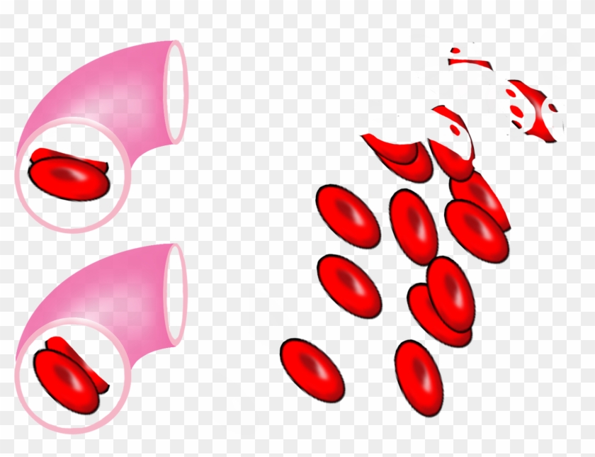 Red Blood Cells > - Red Blood Cells > - Full Size PNG Clipart Images ...