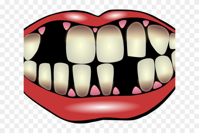 Loose Tooth Cliparts - Cause And Effect Visual Cards - Full Size PNG ...