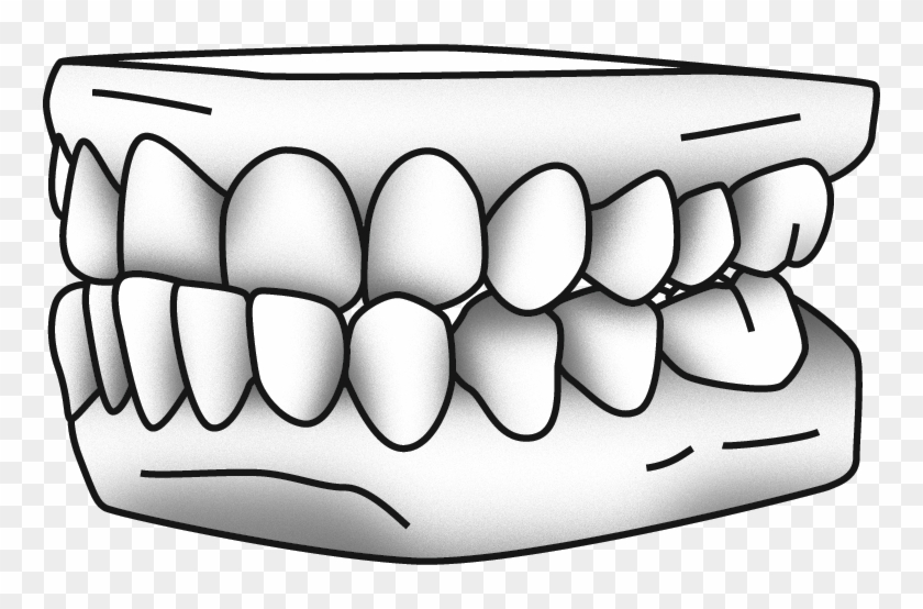 Denture Drawing - Denture Drawing - Full Size PNG Clipart Images Download