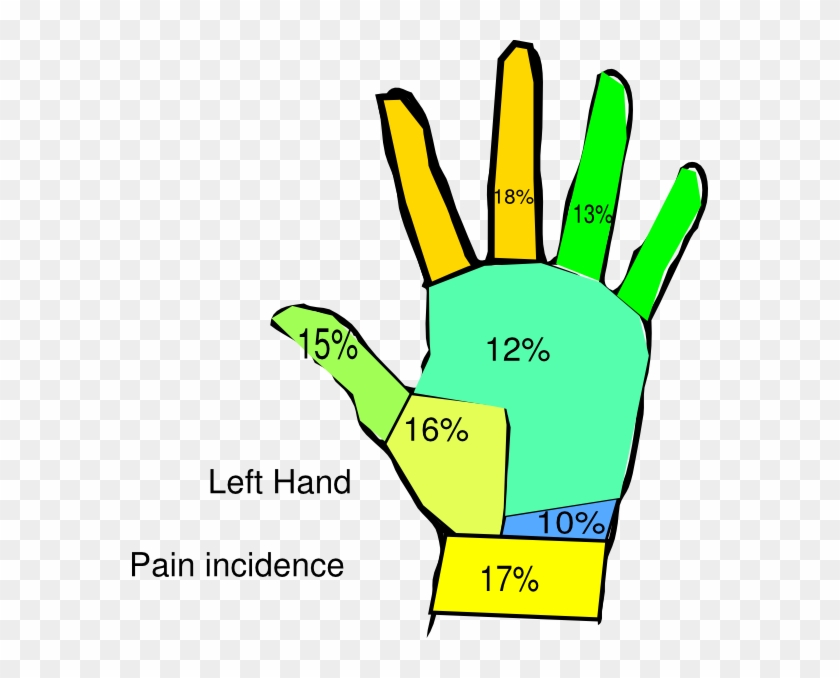 Left Hand Pain Incidence Surgeon Clip Art - Pain On Left Hand - Full ...