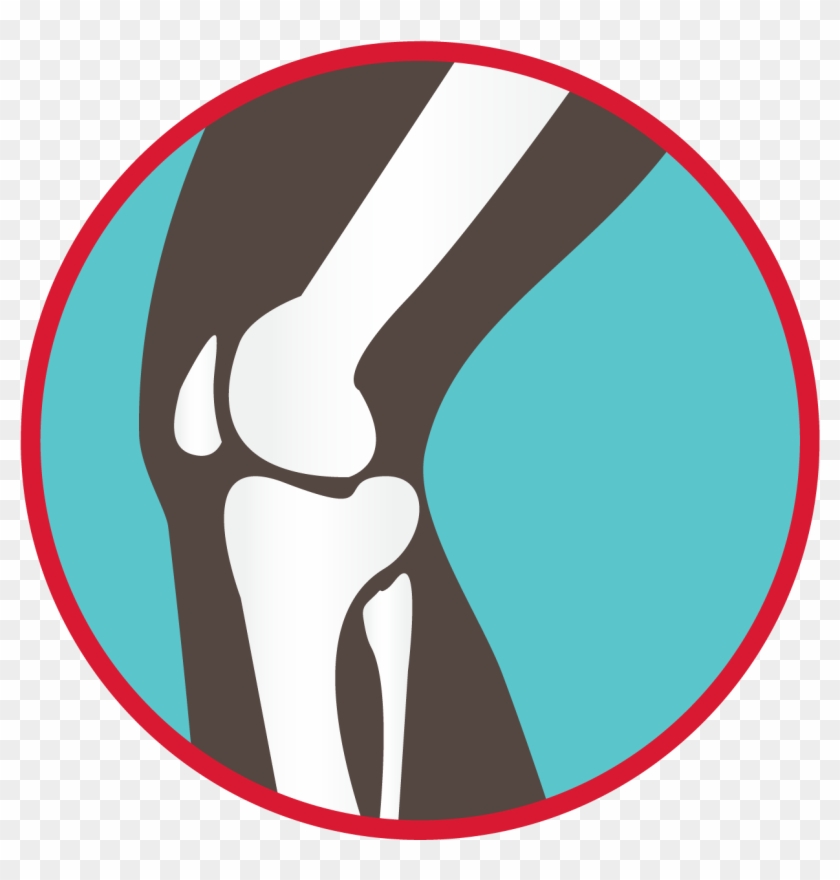 Bones Of The Knee Joint Graphic - Howth - Full Size PNG Clipart Images ...