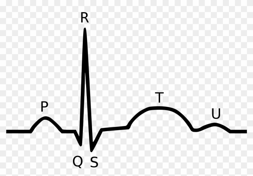 Px Qrs Fasterskier - Qrs Complex - Full Size PNG Clipart Images Download