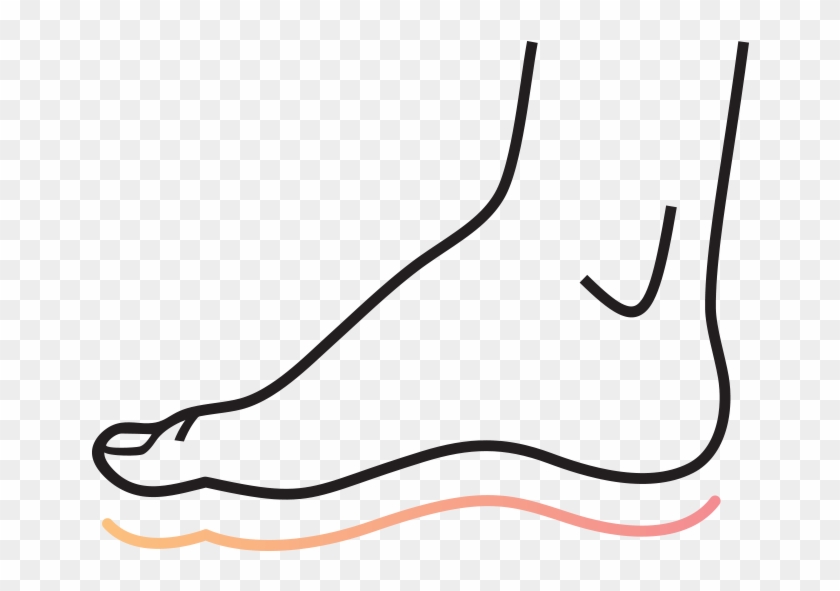 Diabetic Foot - Diabetic Foot - Full Size PNG Clipart Images Download