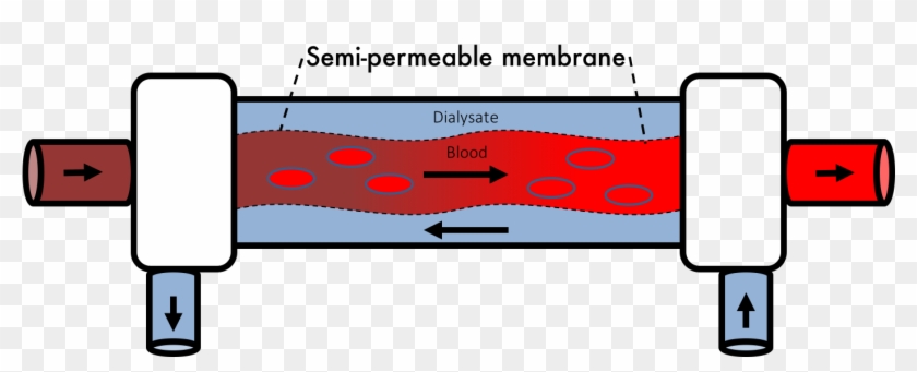 High Efficiency - Low Flux Dialyzers - Full Size PNG Clipart Images ...