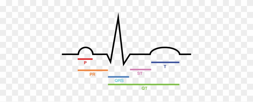 File - Ecg Intervals - Svg - Sa Node Damage On Ecg - Full Size PNG ...