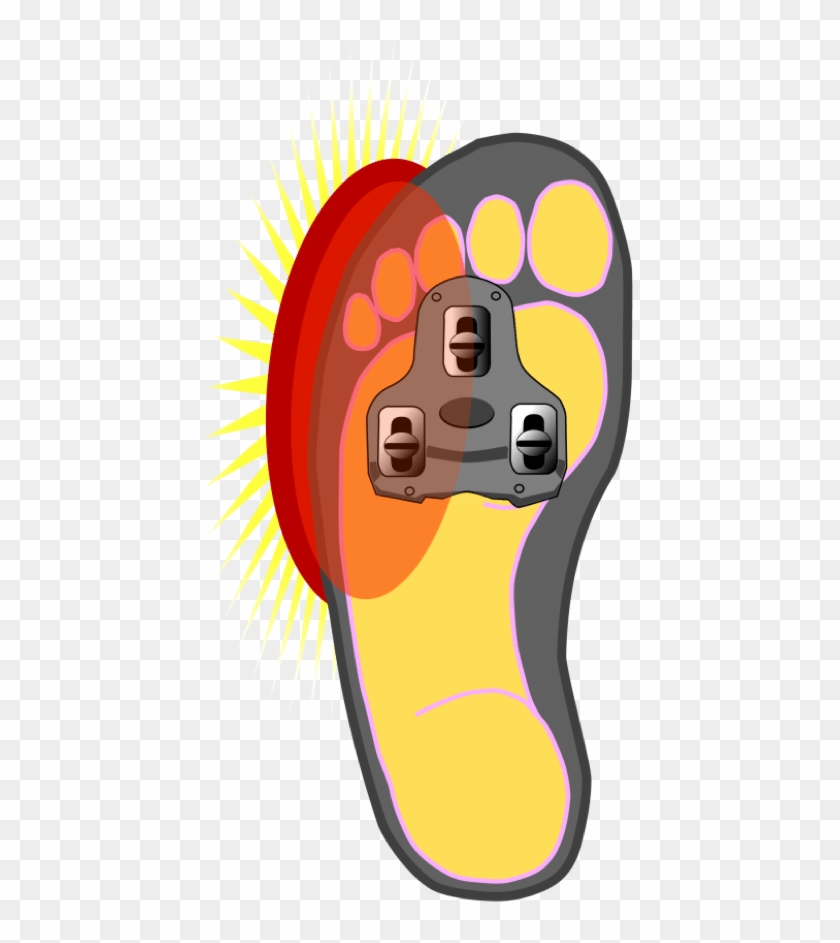 Hurt Clipart Foot Pain - Hurt Clipart Foot Pain - Free Transparent PNG ...