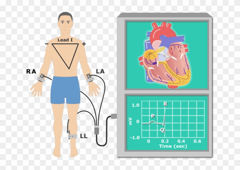 Ecg Cartoon Clipart Electrocardiography The Electrocardiogram - Ecg ...