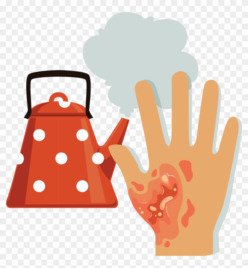 Heat Burn-01 - Burn Hand Vector - Full Size PNG Clipart Images Download