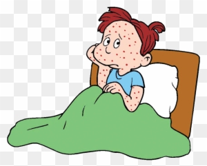 Chicken Pox Clipart - Free Transparent PNG Clipart Images Download