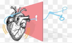 Cardiac Surgery - Cartoon Human Heart - Free Transparent PNG Clipart ...
