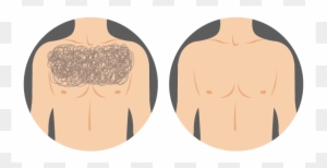 Skin Preparation - Illustration - Free Transparent PNG Clipart Images ...
