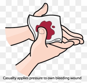 Apply First Aid Online Rh Nsfsakai Nthsydney Tafensw - Apply Pressure ...