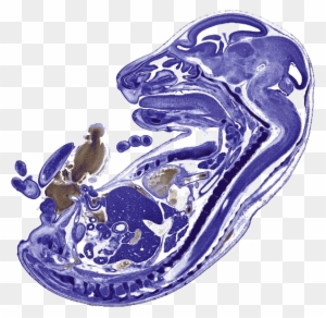 Rat Fetus - Sagittal Section Of Rat Embryo - Free Transparent PNG ...