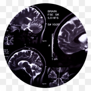 Diagnosis And Treatmentlearn More - Traumatic Brain Injury - Free ...