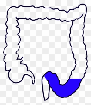 Sigmoid Colon - Sigmoid Colon - Free Transparent PNG Clipart Images ...