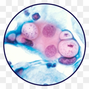 Chlamydia-circle420 - Chlamydias Trachomatis - Free Transparent PNG ...